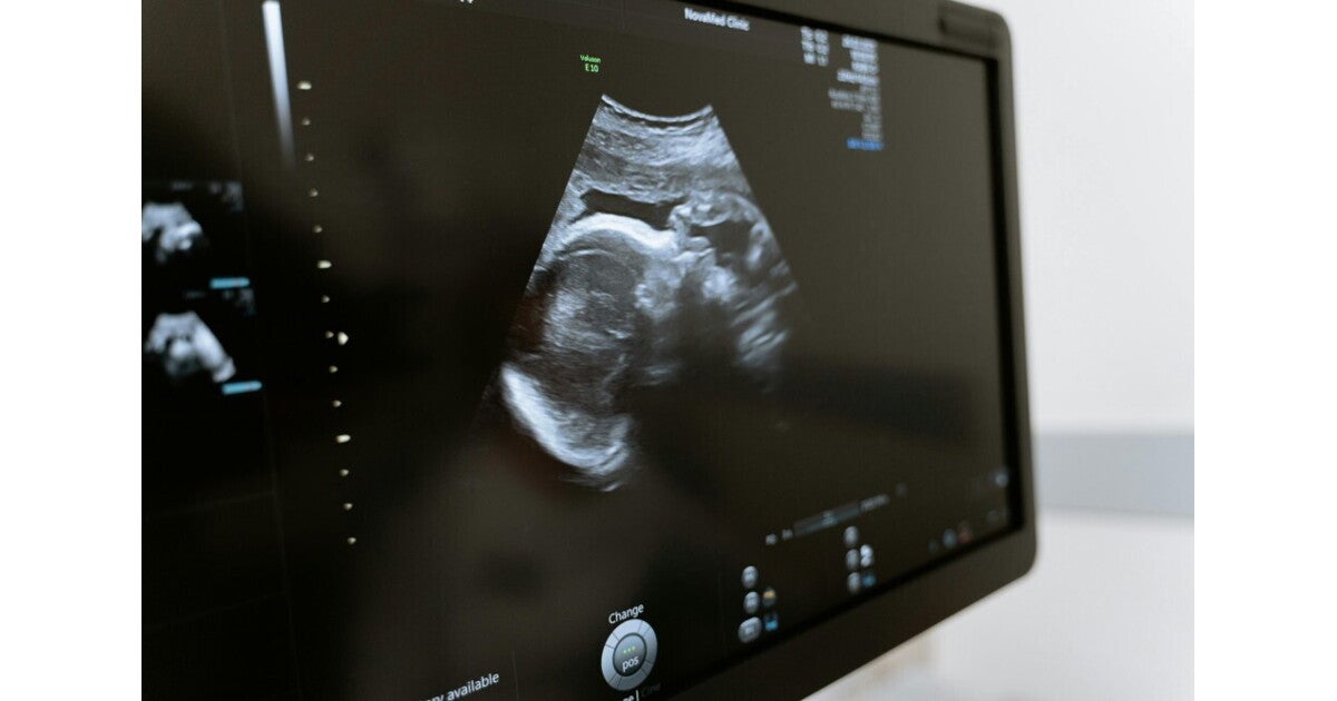 Can You Get Pregnant from Precum? Understanding the Risks | parenTeam